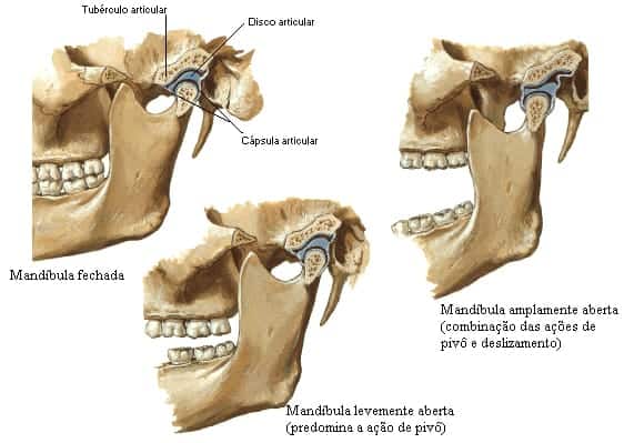 Disfunção da articulação temporomandibular (DTM) e Dor Orofacial ...