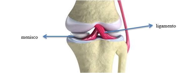 Lesão de menisco: trauma comum do joelho | Clínica Dr. Hong Jin Pai ...