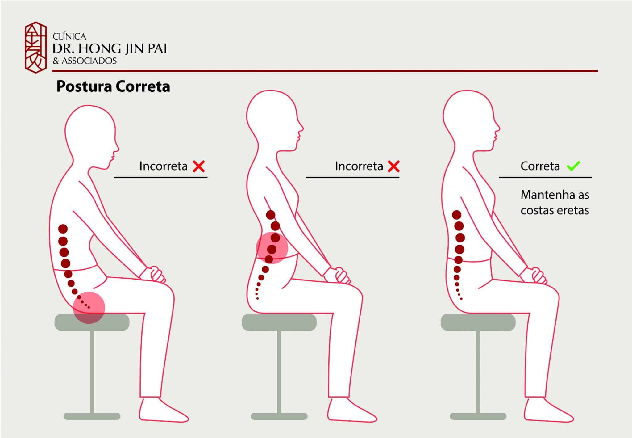 Dor no Cóccix (Coccidínia) - O que pode ser? Quando se preocupar ...
